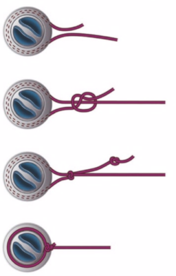 Back To Basics - Fishing Rod & Line Setup Guide - Fulling Mill Blog